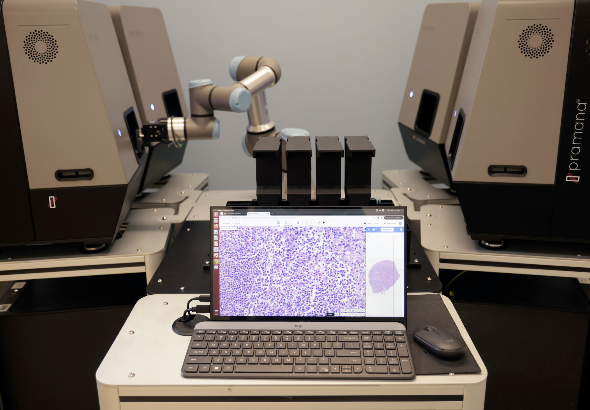 Digital pathology aims to unlock secrets hidden in tissue samples ...