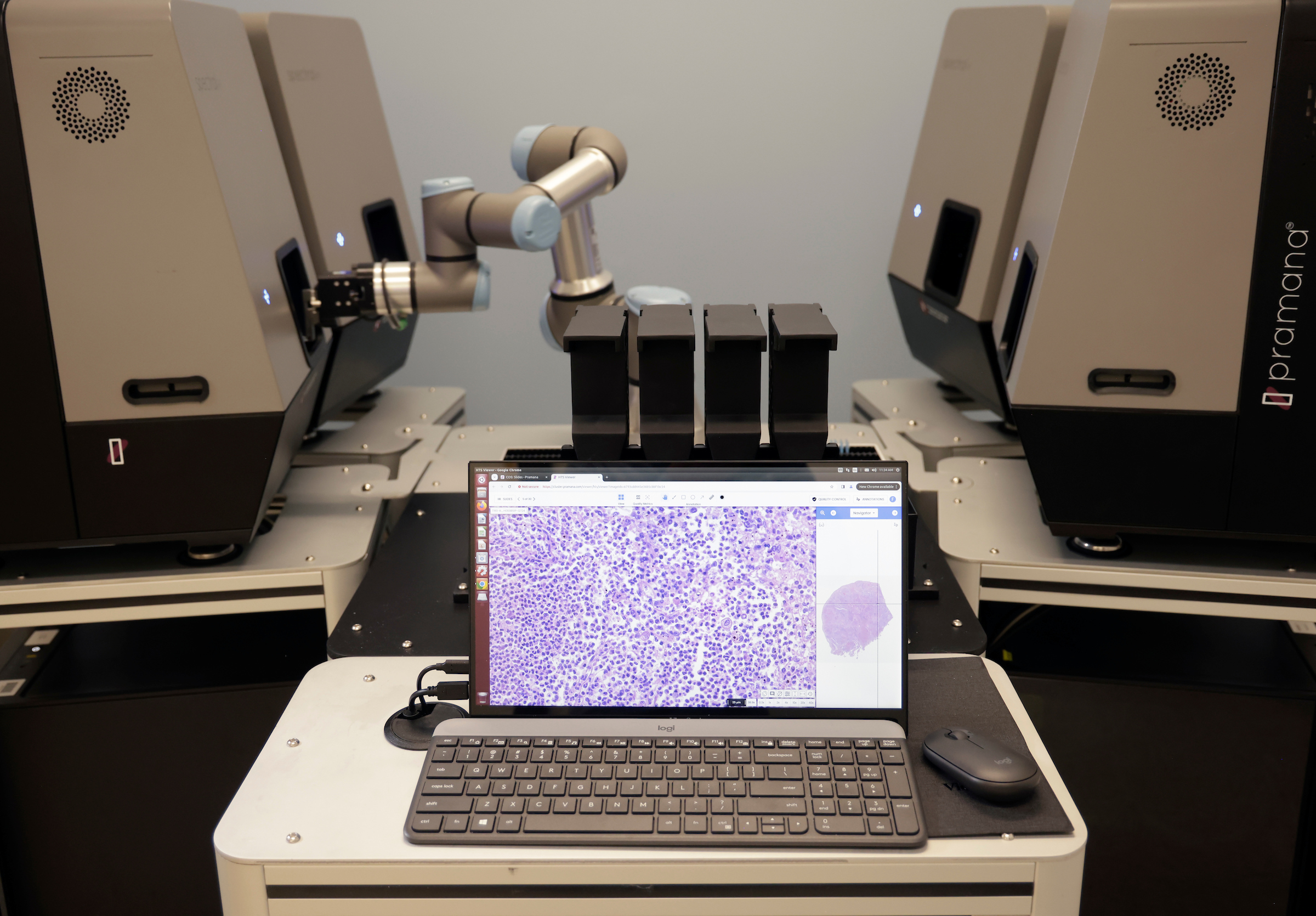 Digital pathology aims to unlock secrets hidden in tissue samples ...