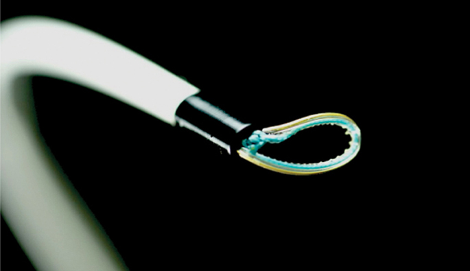 New technique eases stroke risk for atrial fibrillation patients - VUMC ...