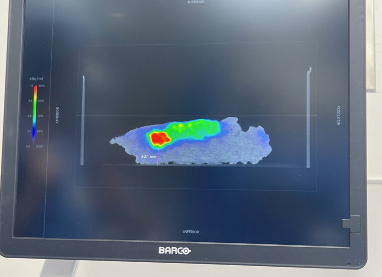 VUMC performs nation’s first surgery using latest generation of ...