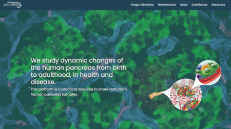 Pancreatlas provides access to complex images of the human pancreas - VUMC News