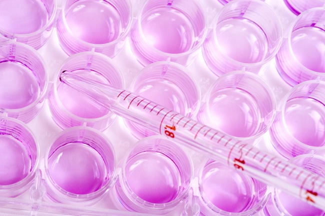 Lean vs. obese adipose tissue cells - VUMC News