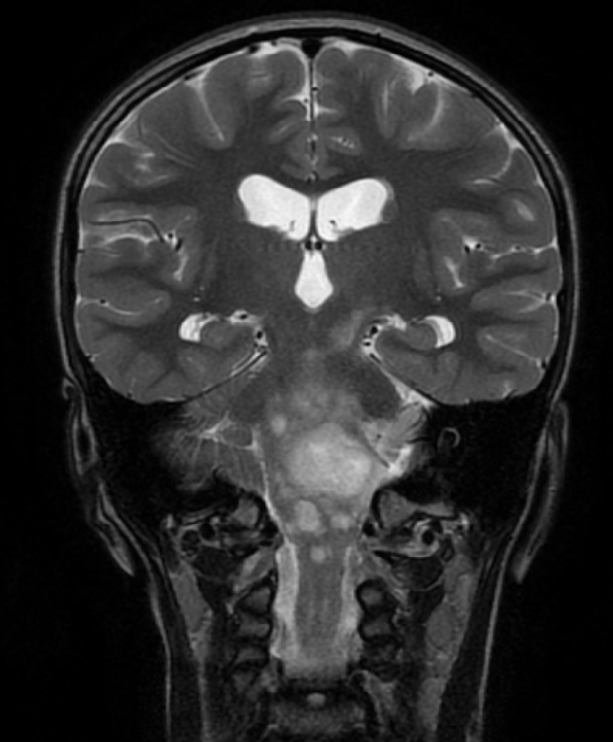Study led by Monroe Carell Jr. Children’s Hospital at Vanderbilt looks ...