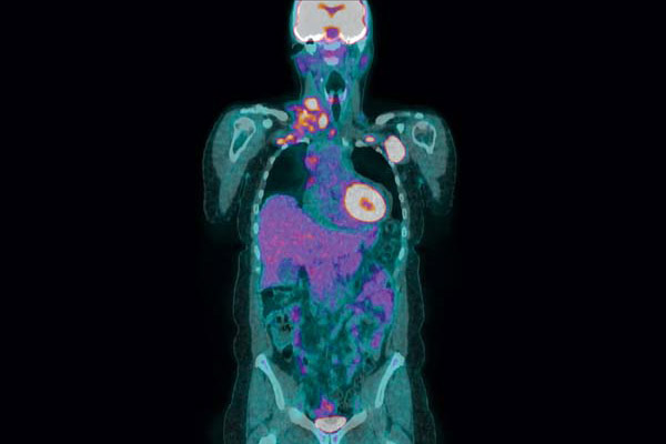 Grant bolsters VUIIS ‘deep tissue’ imaging research - VUMC News