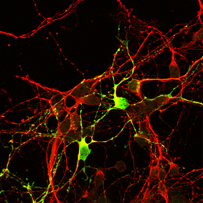 Neural receptor for reovirus - VUMC News