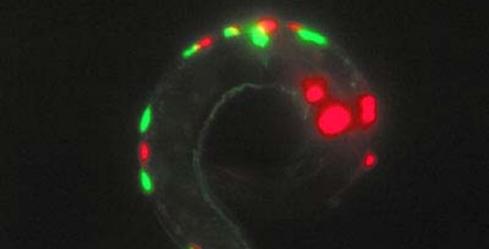 Worm gene function? Check the map. - VUMC News